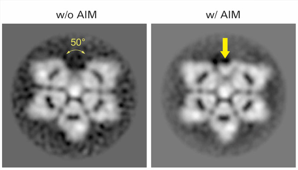 Infektion, Inflammation und Gerinnung – ein immunologisches Triumvirat ...